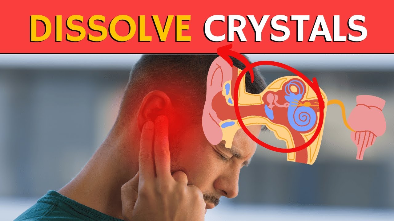 How to DISSOLVE Crystals in the Inner Ear and Get Rid of Vertigo - YouTube