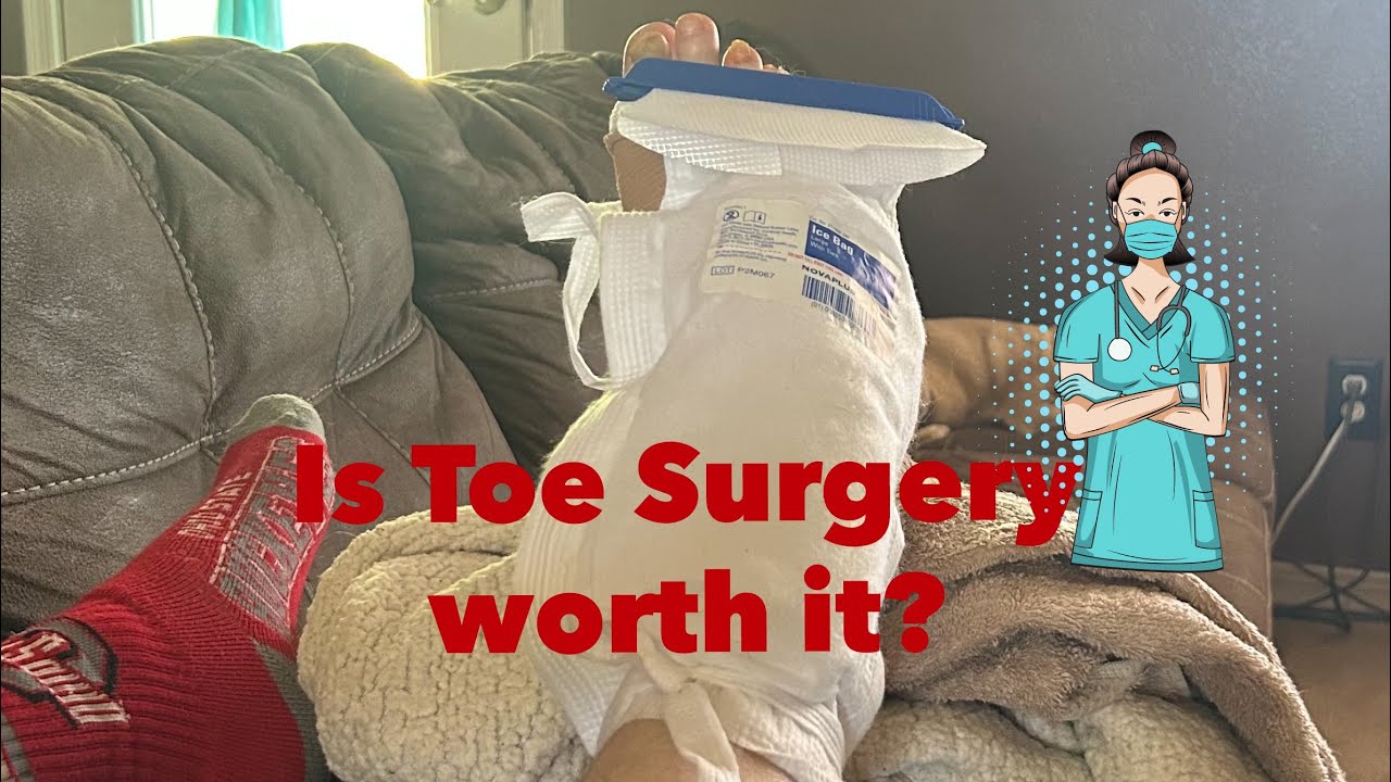 Stumbles had toe surgery! The results after a Cheilectomy #foot # ...