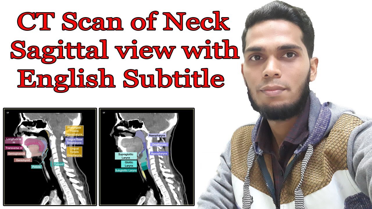 CT scan of neck sagittal anatomy - YouTube