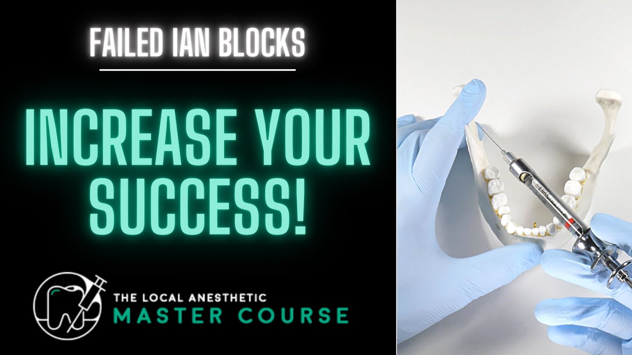 Inferior Alveolar Nerve Block Reasons For Failure | Local-Anesthetic ...