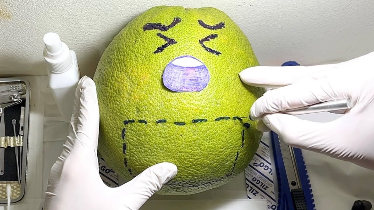 Emergency | Grapefruit Gives Birth ASMR | Fruit Surgery | Satisfying ...