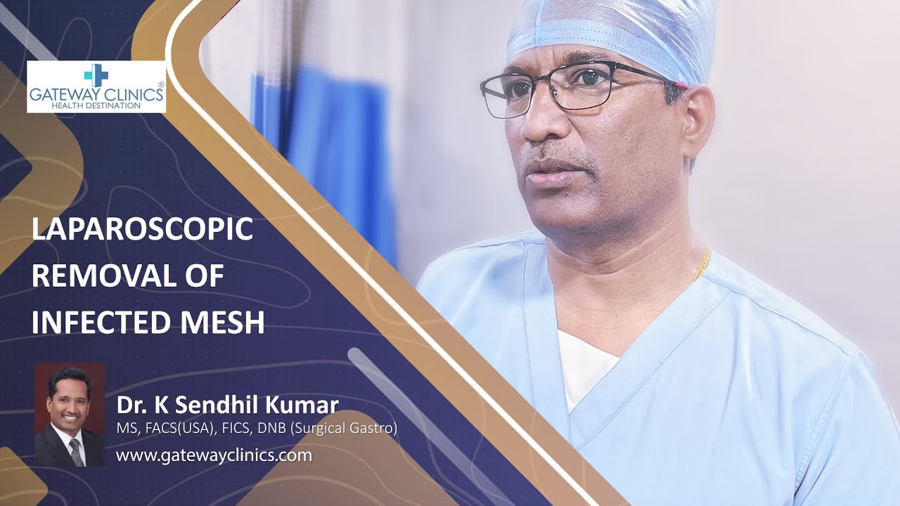 Advanced Techniques in Laparoscopic Removal of Infected Mesh (Gateway ...