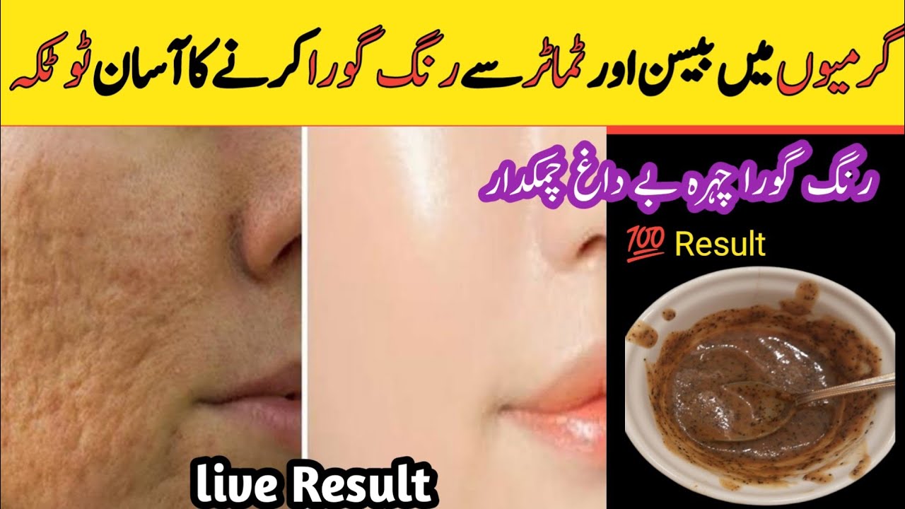 Besan Face pack for glowing skin | Besan Face Pack For Oily Skin | Face ...