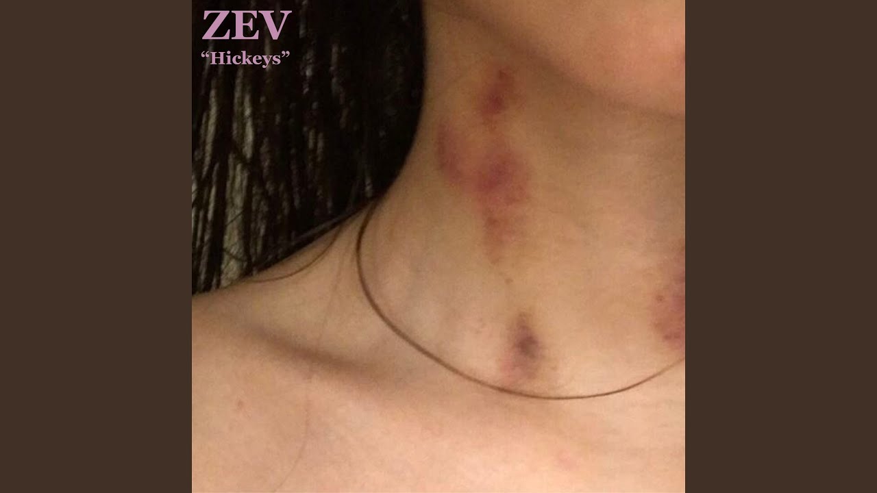 Hickeys (Preview) - YouTube