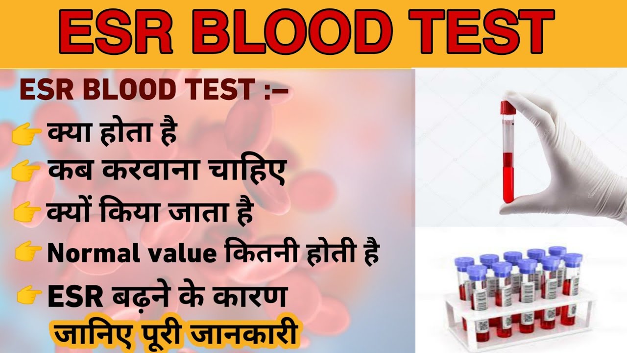 Esr Test In Hindi Esr Test Esr Kya Hota Hai Esr Blood Test Esr esr-test-in-hindi-esr-test-esr-kya-hota-hai-esr-blood-test-esr