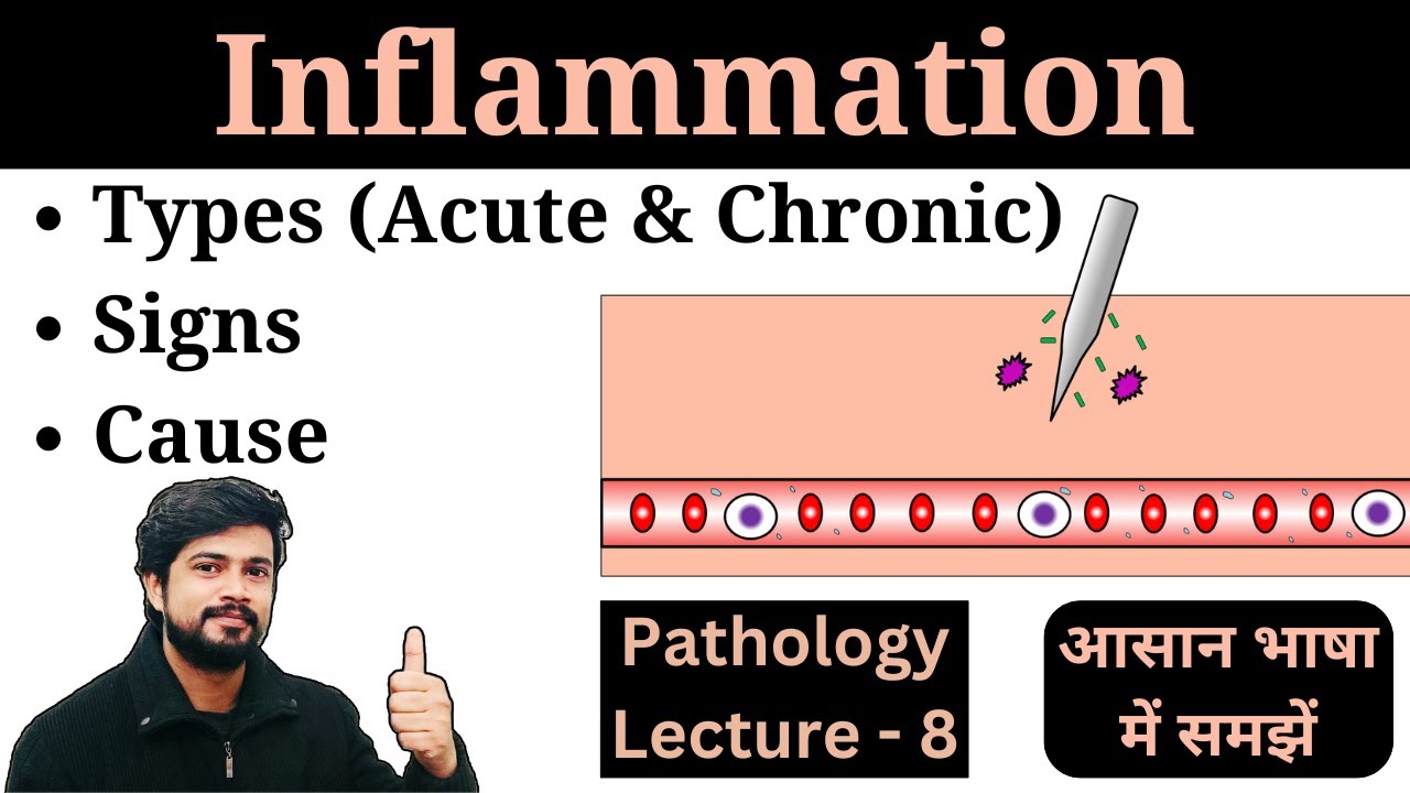 Inflammation Kya Hota Hai Types Acute And Chronic Cause Signs inflammation-kya-hota-hai-types-acute-and-chronic-cause-signs