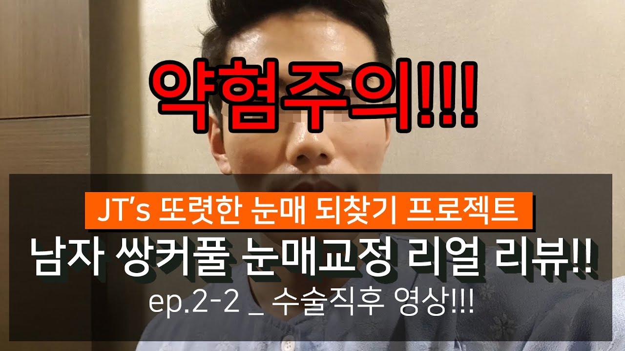 Jt 열정리뷰 남자 자연유착 눈매교정 Double Eyelid Surgery Ep 2 2 수술직후영상 약혐주의