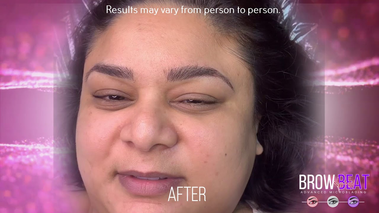 Before and After Treatment Microblading By BrowBeat Studio Dallas - YouTube