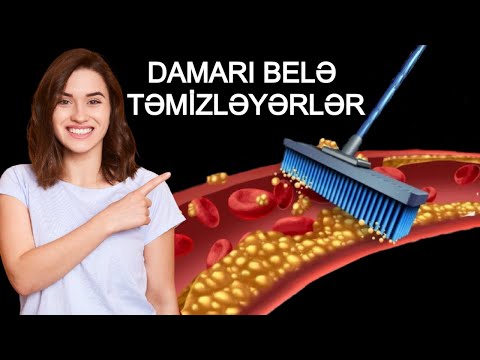 Tutulmuş Damarları TƏR-TƏMİZ EDİN - 90 % İNSAN BİLMİR
