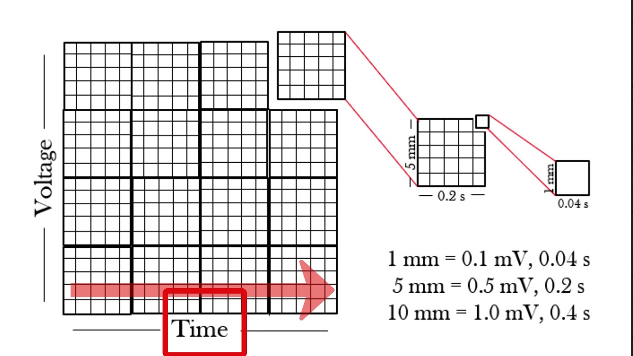 4 ECG Machine Basics - YouTube