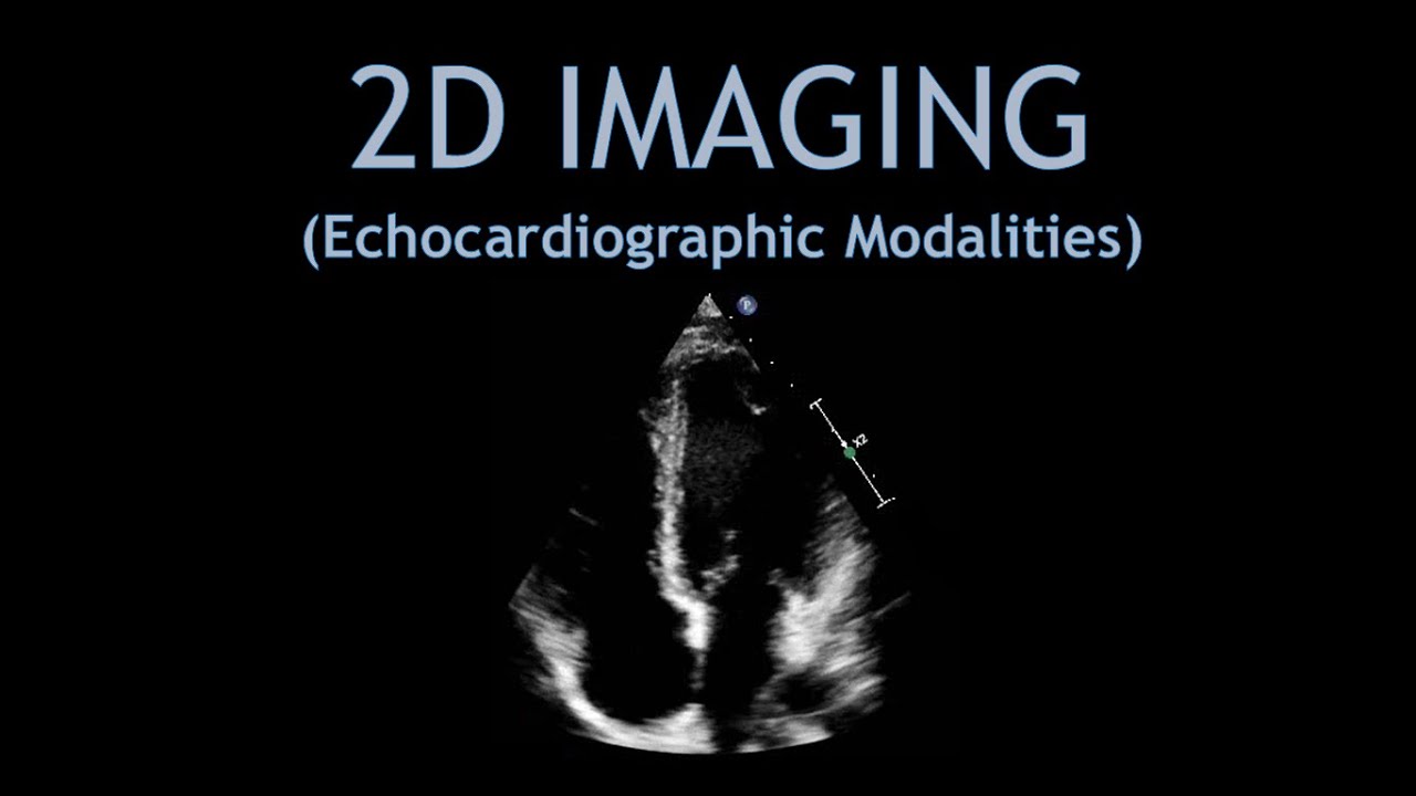 2D IMAGING + Image optimisation! (Echocardiogram). - YouTube