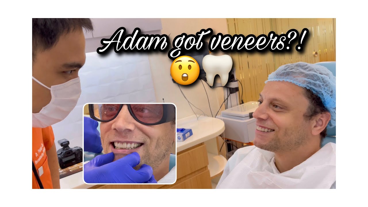 Adam's makeover at CILLO SMILE DESIGN 🦷 | Justin Alcazar | 2022 - YouTube