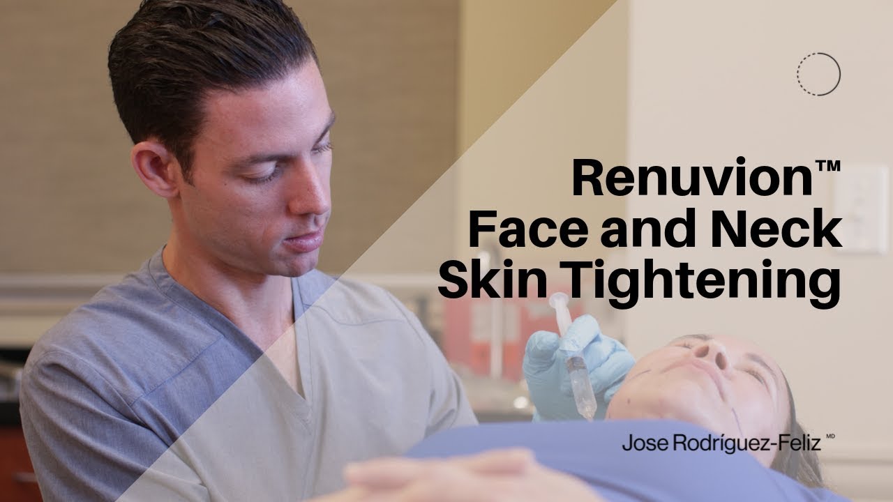 Renuvion™ Face and Neck Skin Tightening - YouTube