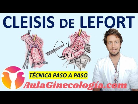 COLPOCLEISIS DE LEFORT: TÉCNICA QUIRÚRGICA PASO A PASO. - Ginecología y ...