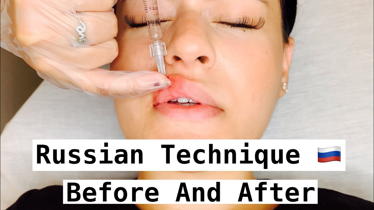 Russian Lip Technique - with Before and After - YouTube