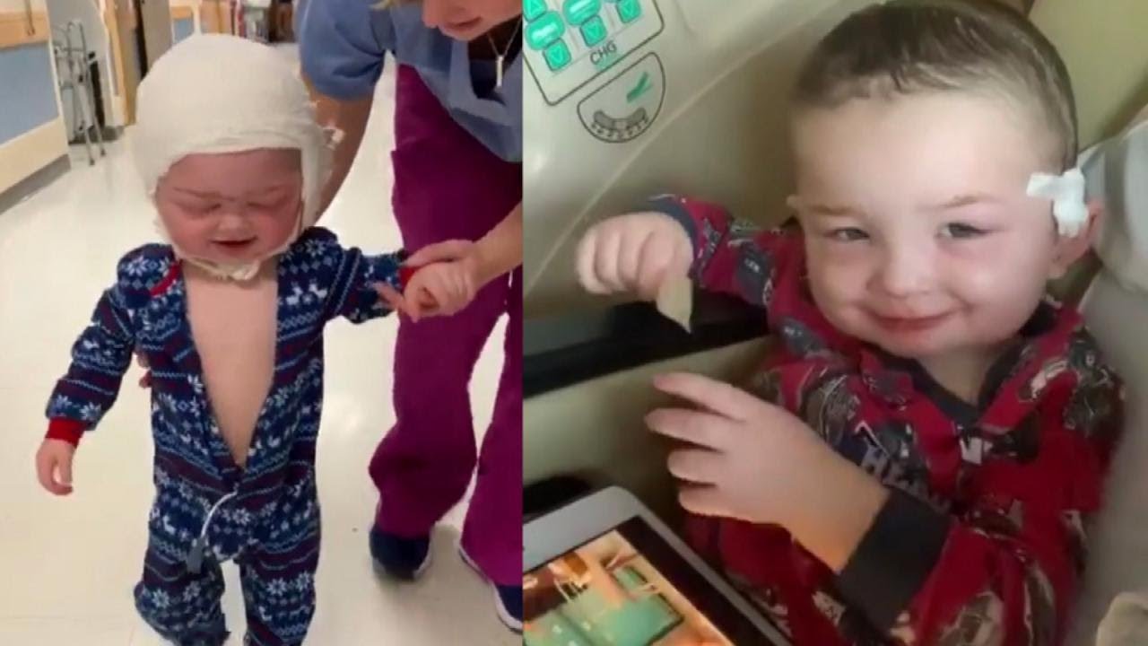 Toddler Excited to Take 1st Steps After Skull Surgery - YouTube