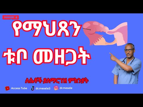 የማህፀን ቱቦ መዘጋት  ምክንያቶቹ እና መፍትሄው