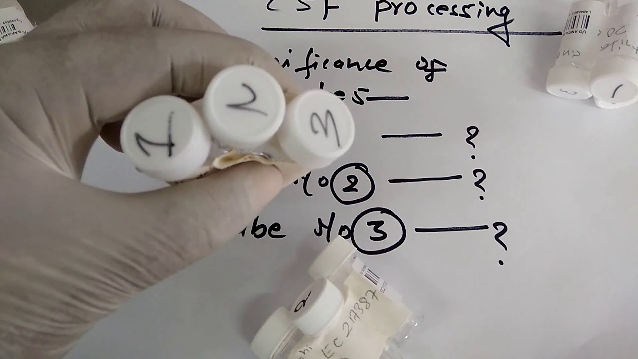 Significance of CSF tubes during CSF processing - YouTube