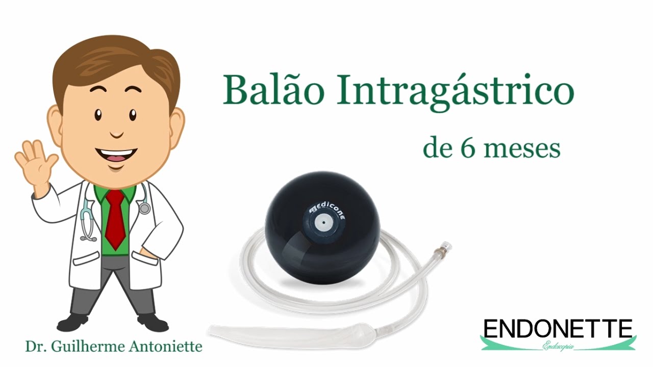 Colocação do Balão Intragástrico de 6 meses - YouTube