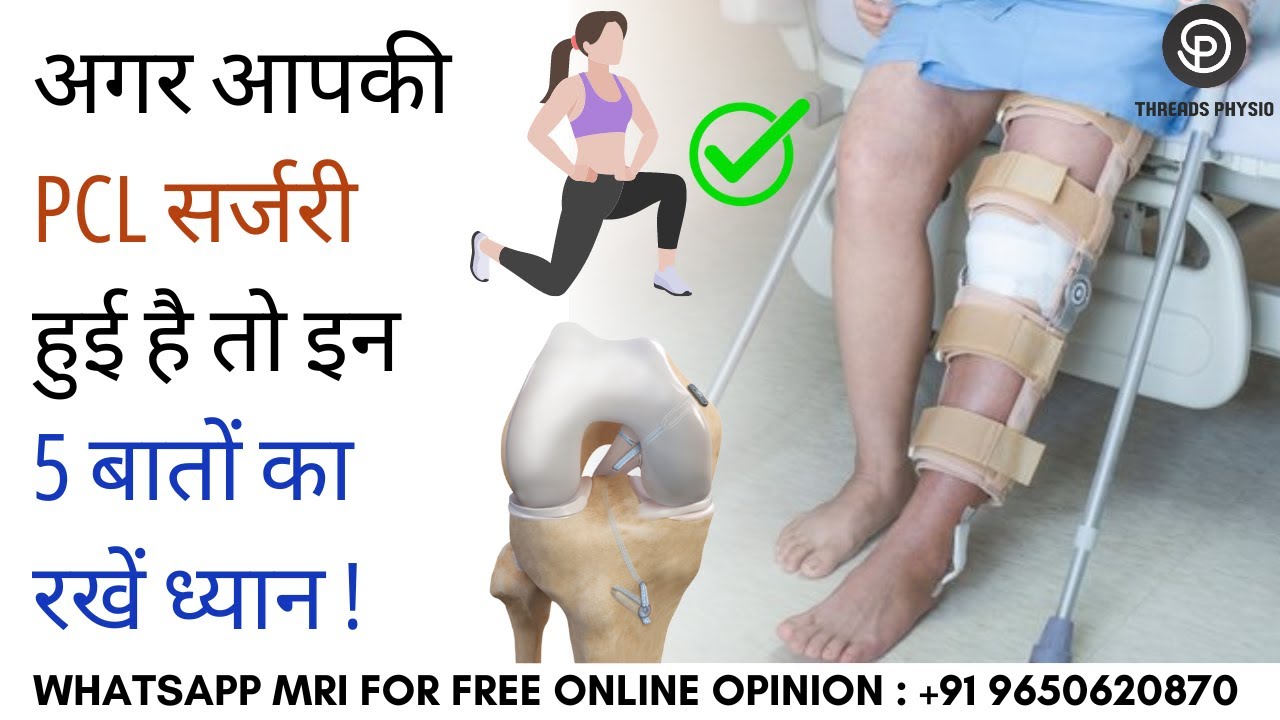 PCL Surgery हुई है तो इन 5 बातों का रखें ध्यान ! 5 Important Things for ...