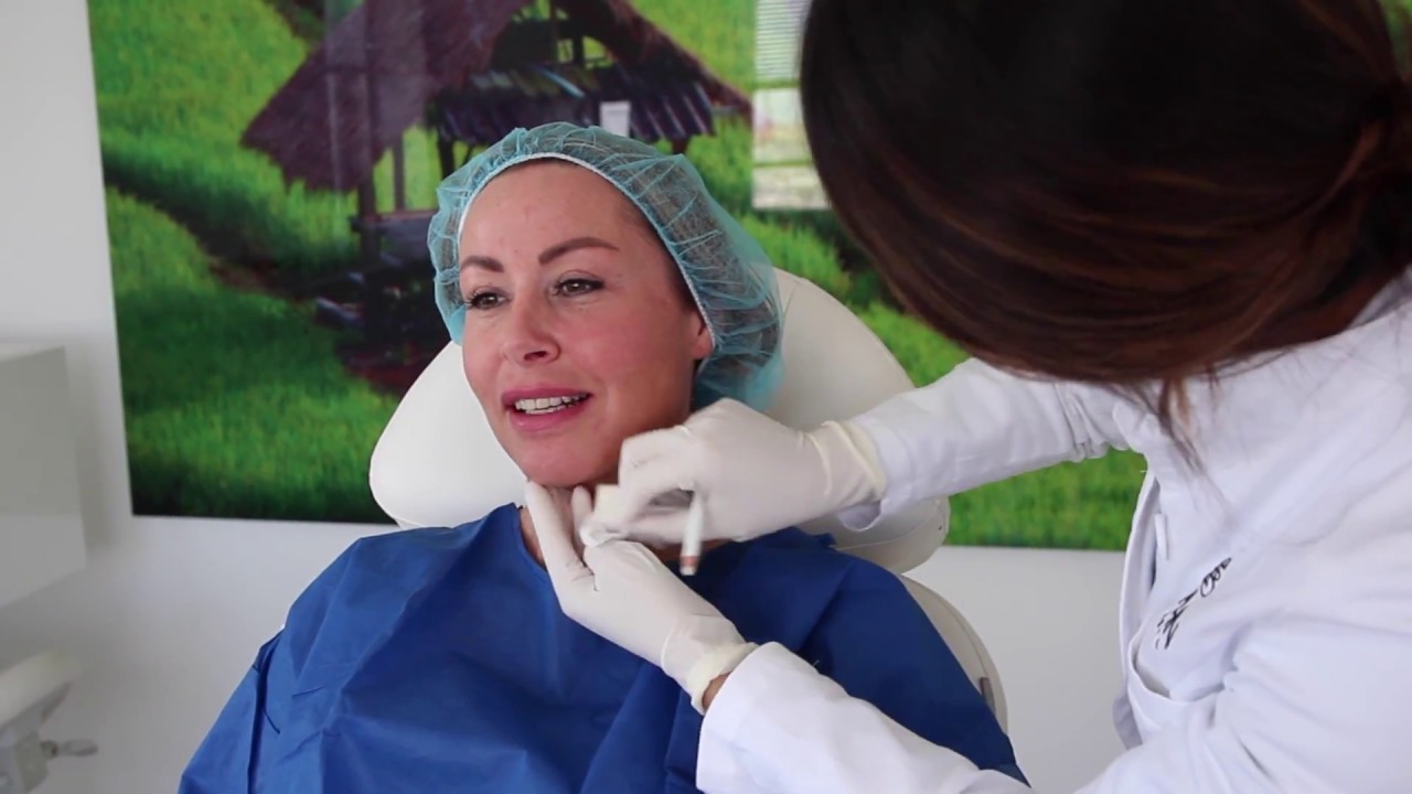 Skin+Surgery Clinics - Draadlift behandeling - YouTube