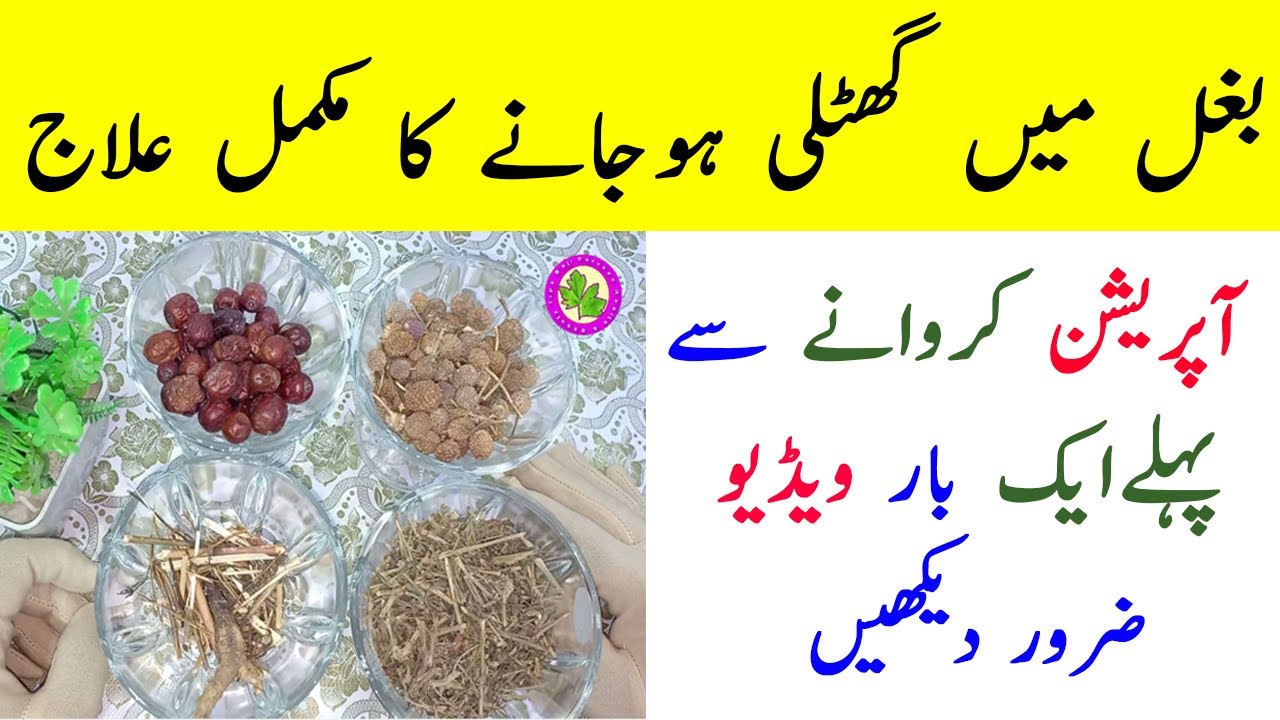 Armpit Lump Treatment - Under Arms Cyst Treatment At Home - YouTube