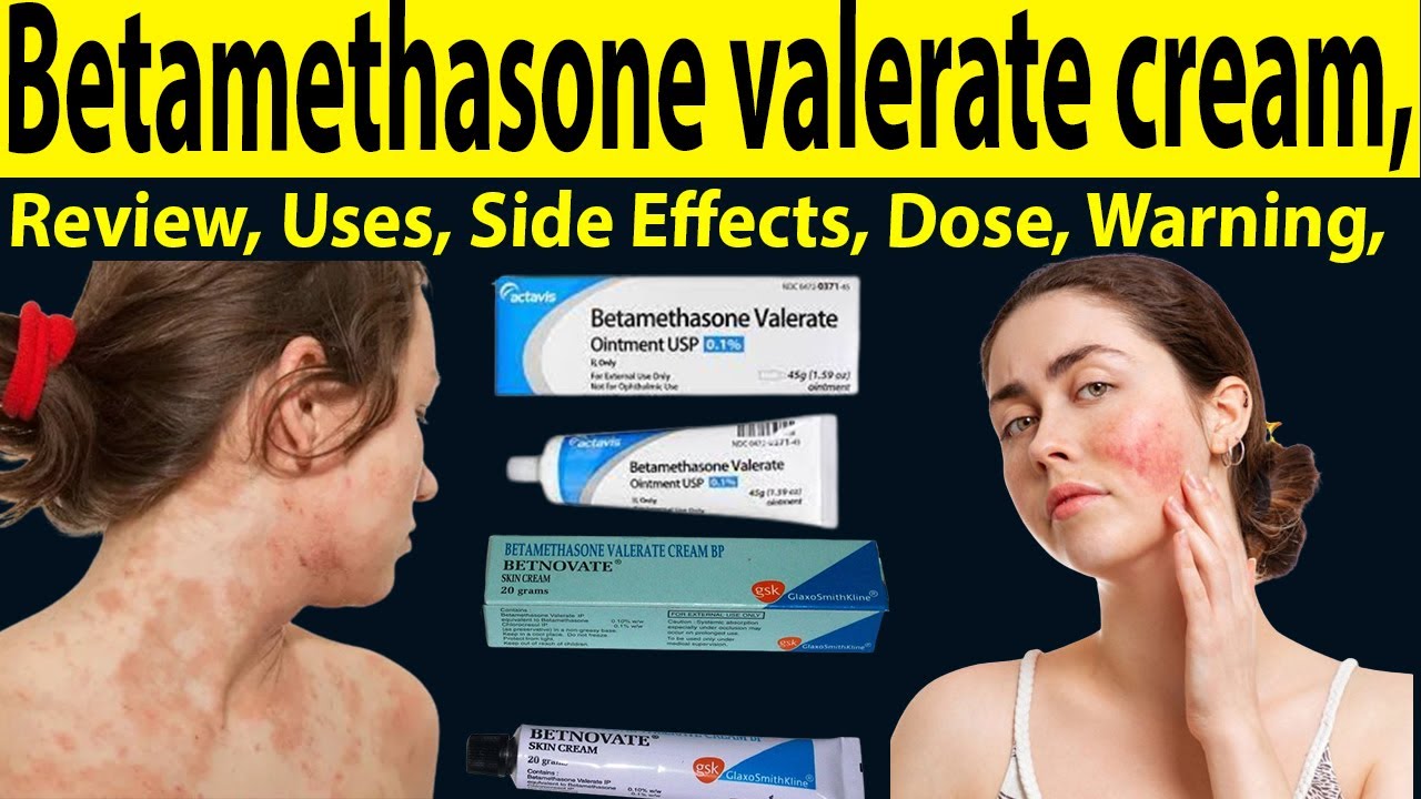 betamethasone sodium phosphate tablets i p 0.5 mg, Betamethasone ...