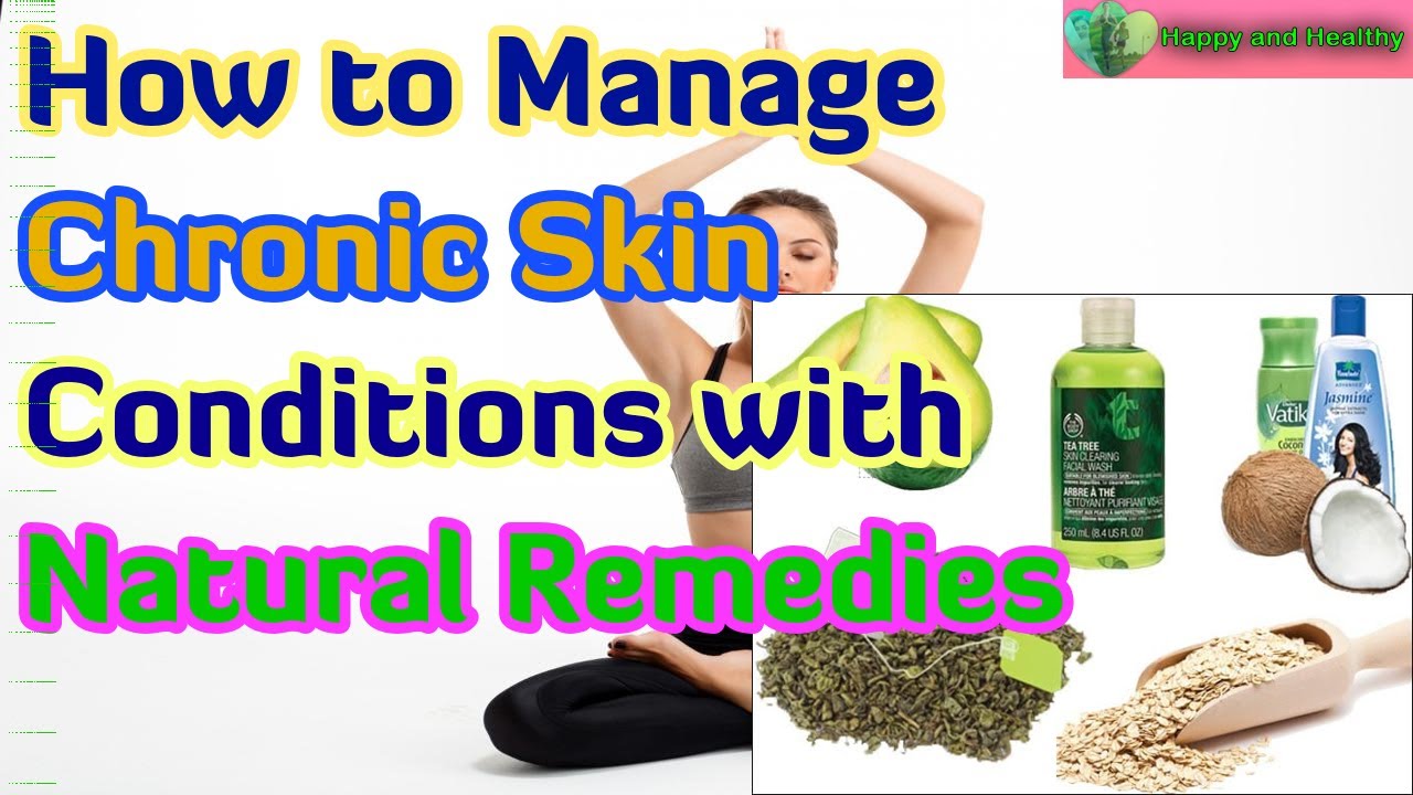 How to Manage Chronic Skin Conditions with Natural Remedies - YouTube
