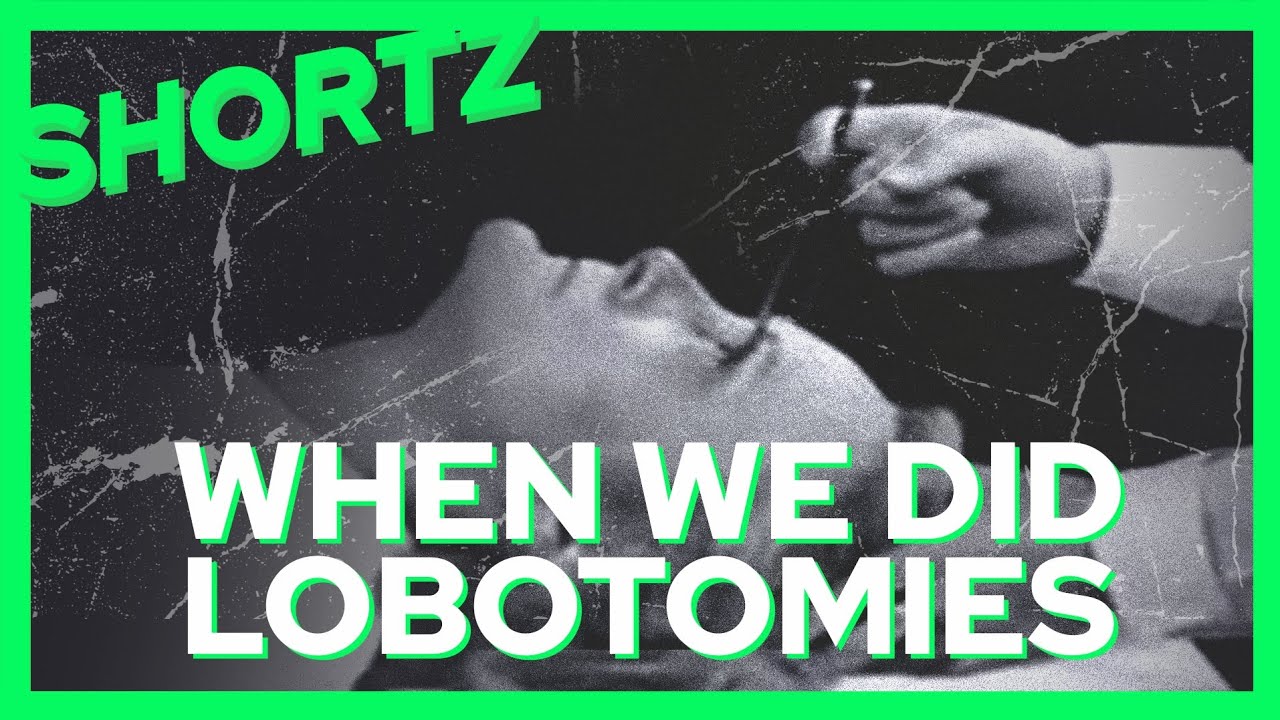 When we did Lobotomies #lobotomy #creepy #medical - YouTube