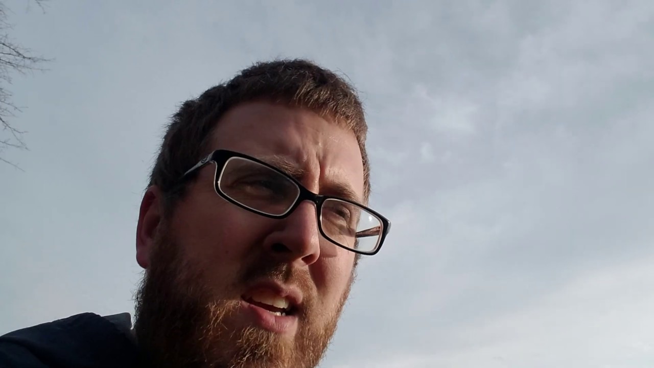 boogie2988 was VERY DISHONEST About His G4 by Golpa Major Teeth Surgery ...