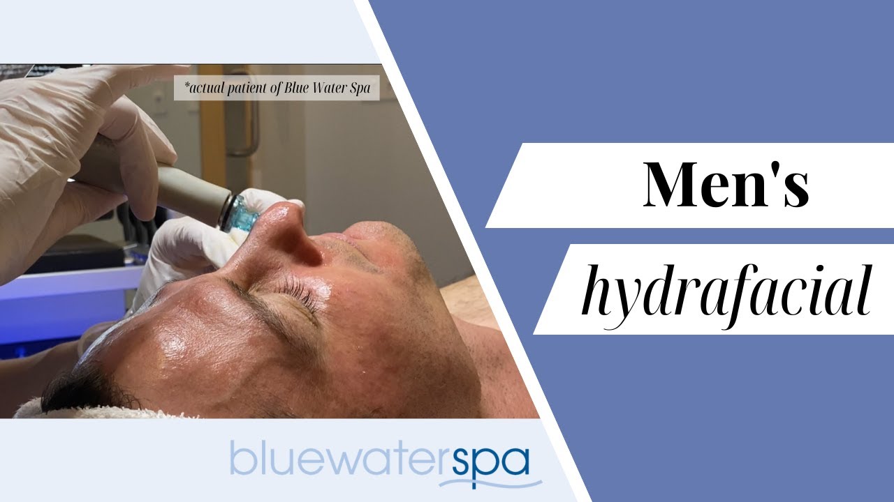 Hydrafacial for Men Review Raleigh Med Spa | Men's Hydrafacial Review ...