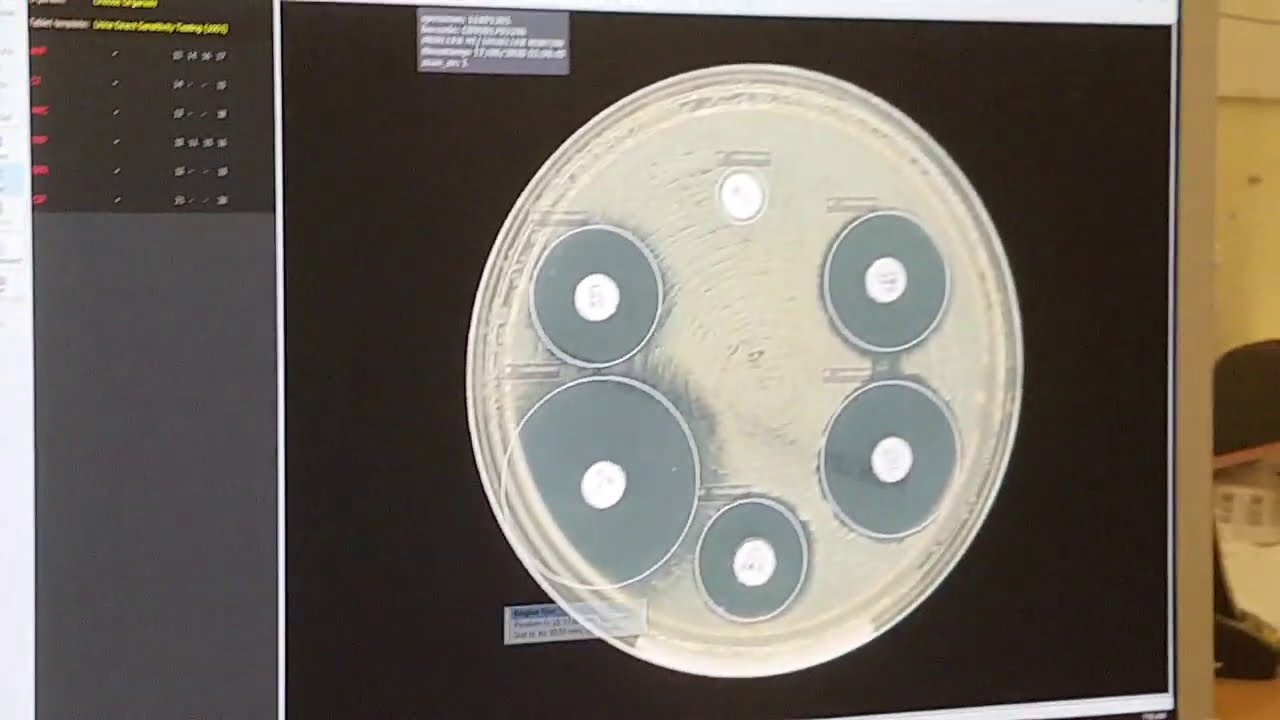 Kiestra_Auslab Results Interface 3 - Organism and susceptibility ...