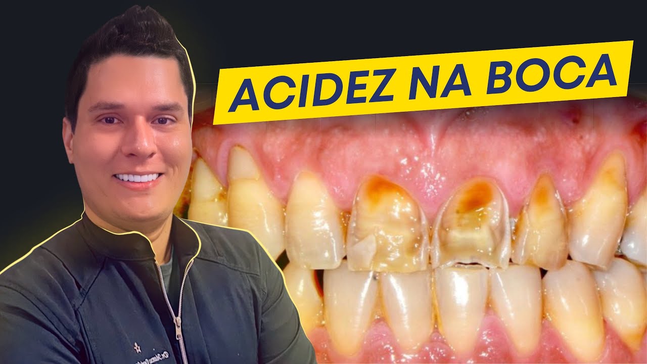 ACIDEZ NA BOCA: CAUSAS E TRATAMENTO! - YouTube