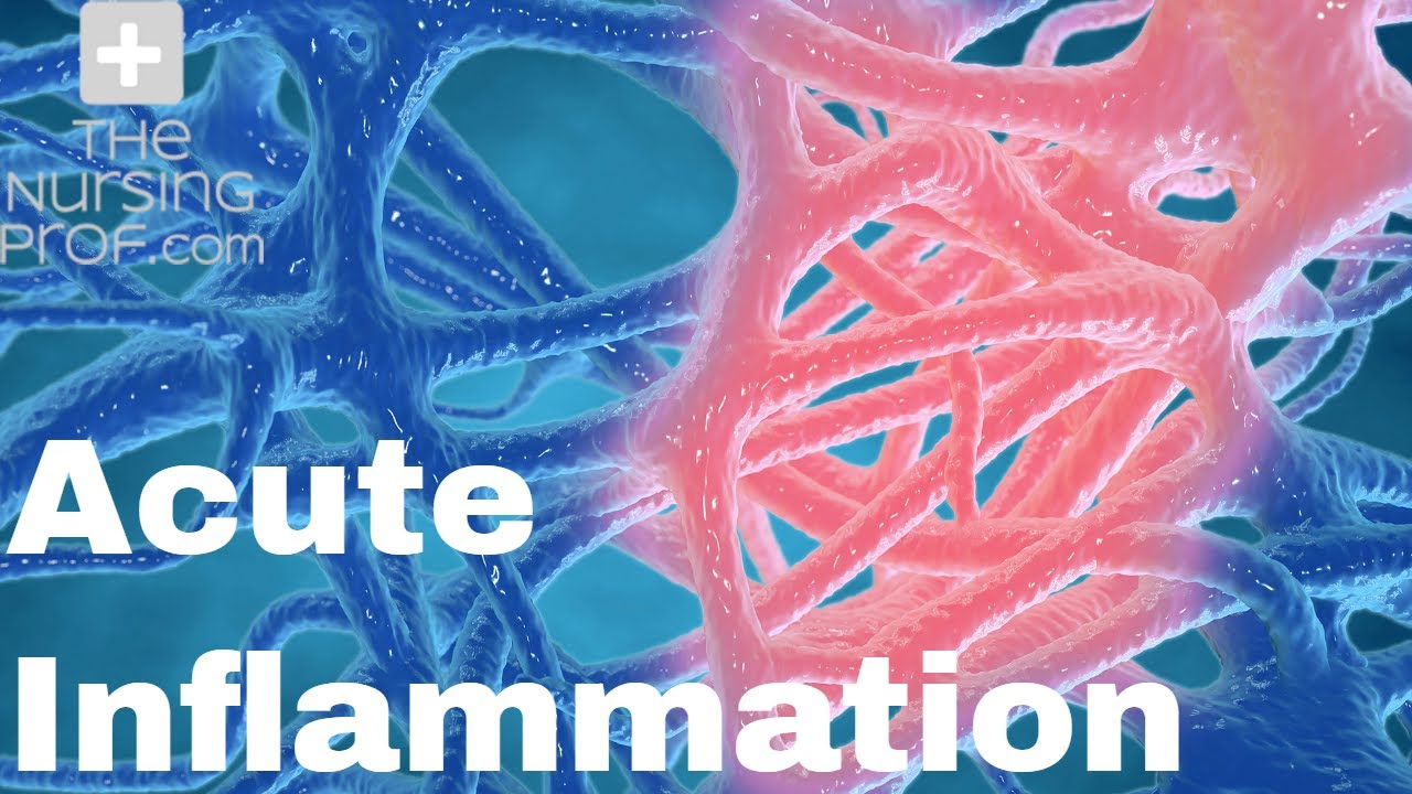 Acute Inflammation: The First Line of Defense. - YouTube