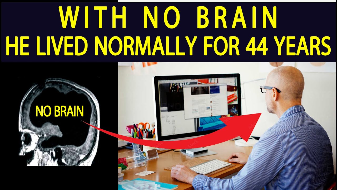 This Man Lived With Almost No Brain – and No One Noticed. - YouTube