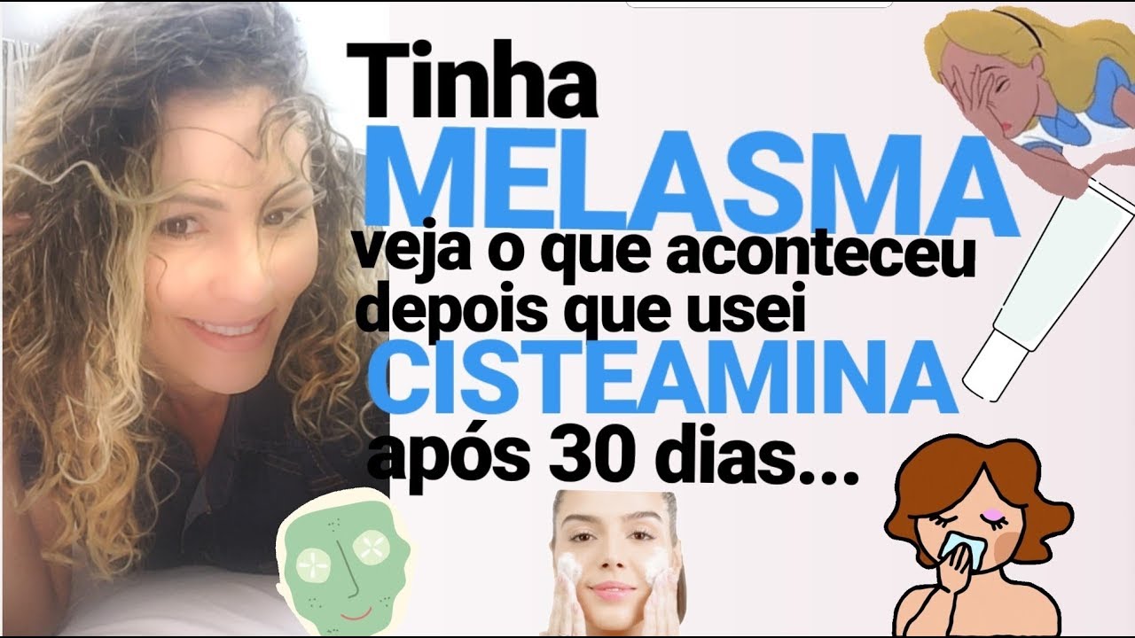 CISTEAMINA 30 DIAS DE USO (Tratamento eficaz para melasma resistente ...