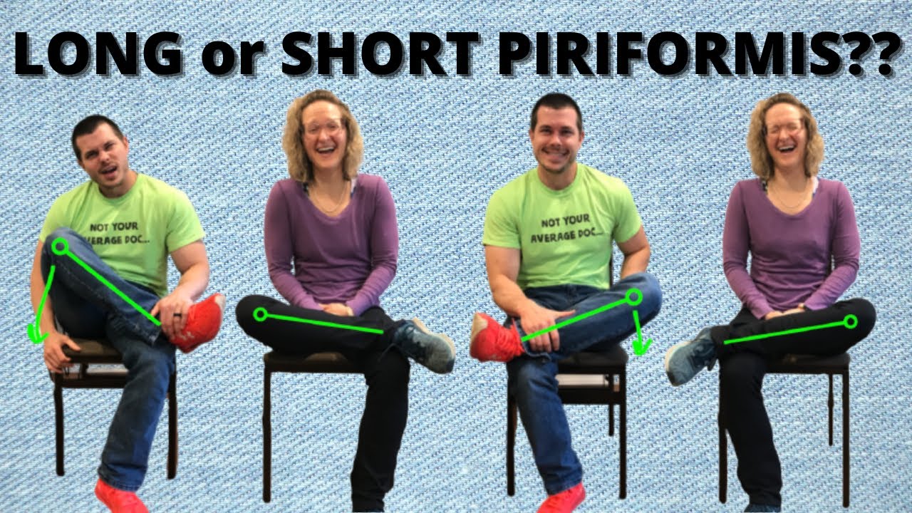 What You Need To Know About Long vs Short Piriformis Syndrome - YouTube