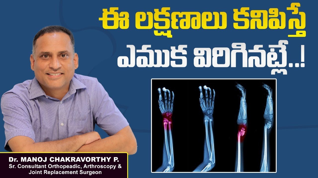 విరిగిన ఎముక లక్షణాలు || Bone Fracture Symptoms in Telugu || Dr Manoj Chakravarthy || Healthy ...