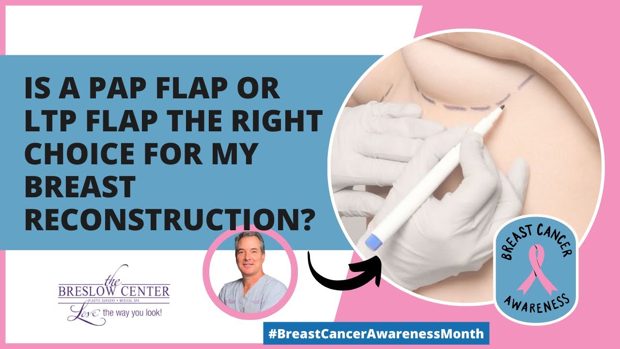 Is a PAP Flap or LTP Flap the Right Choice for My Breast Reconstruction ...
