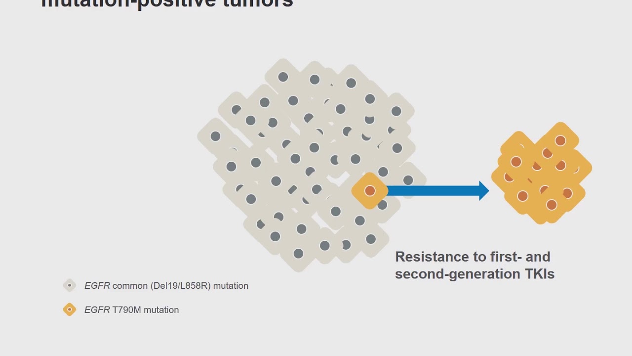 Tumor clonality in EGFR mutation-positive NSCLC - YouTube