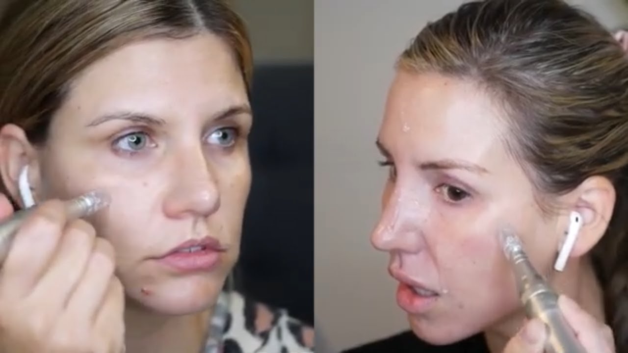 Sensitive Vs Normal Skin With THE Illuma Pen | At Home Microneedling ...