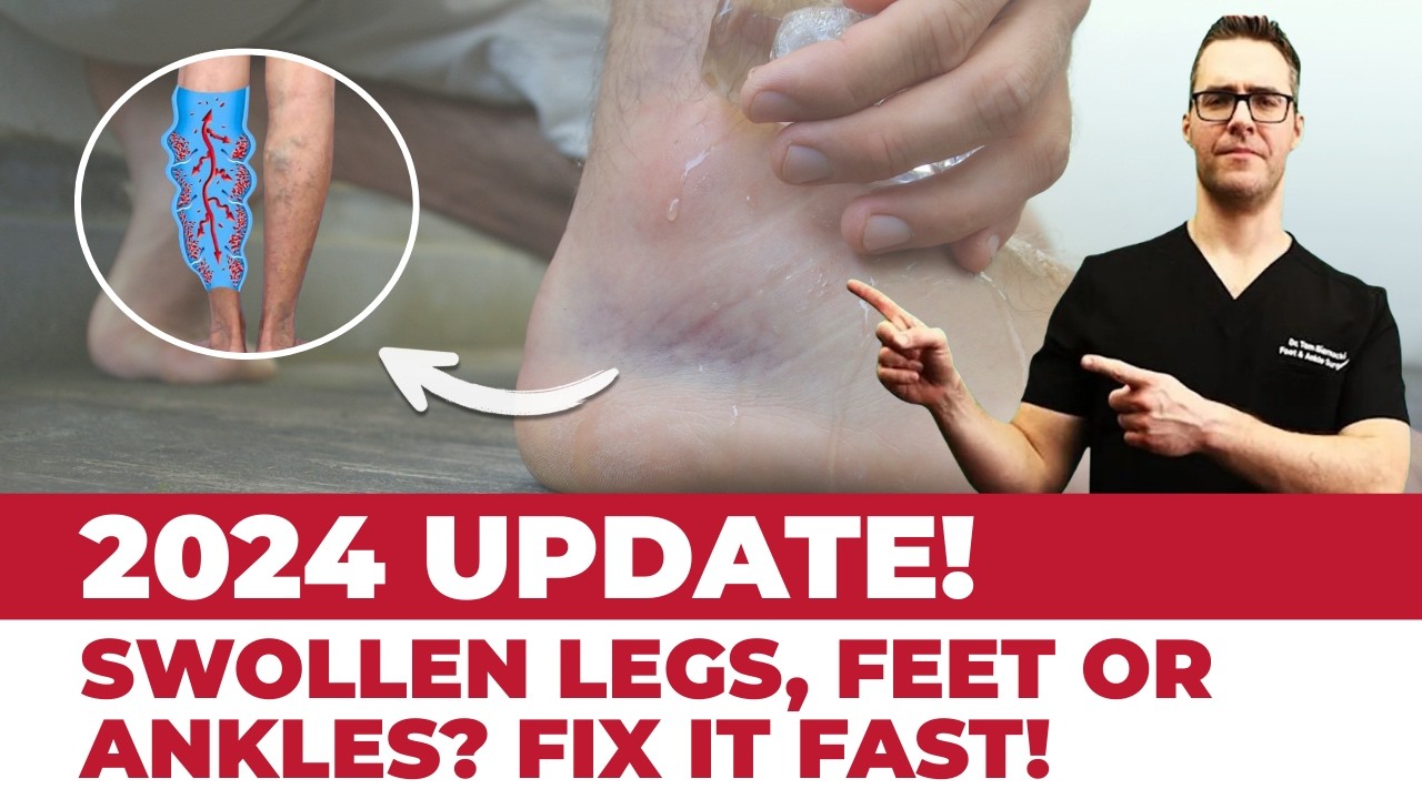 #1 Cause of Swollen Ankles, Legs or Feet? [What Causes It, Dangers ...