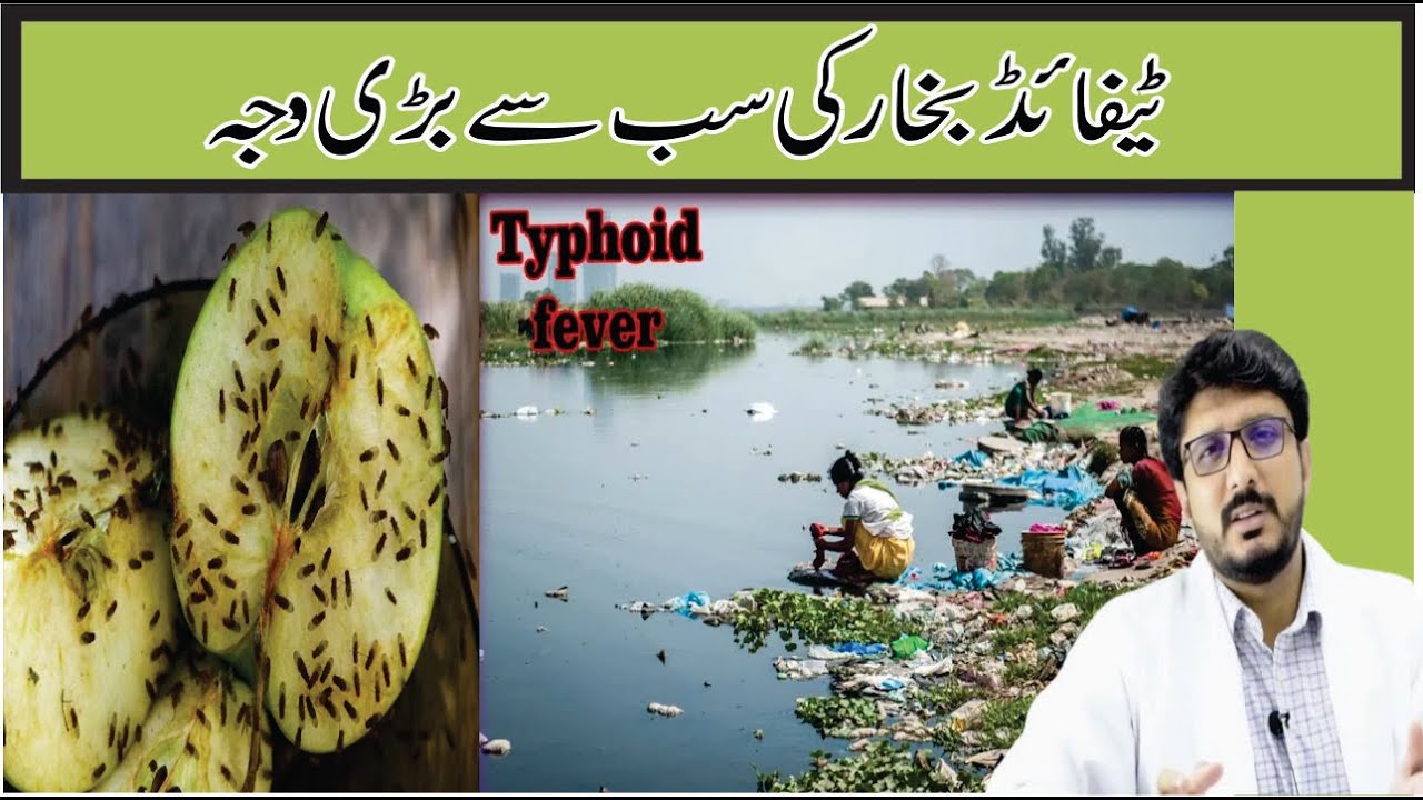 typhoid || typhoid symptoms || typhoid treatment || typhoid source of ...
