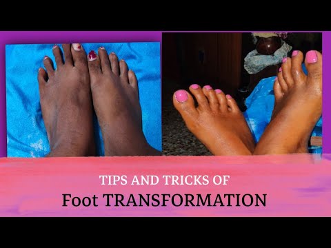 foot transformation during summer #tricks #youtube #begginers #wonen # ...
