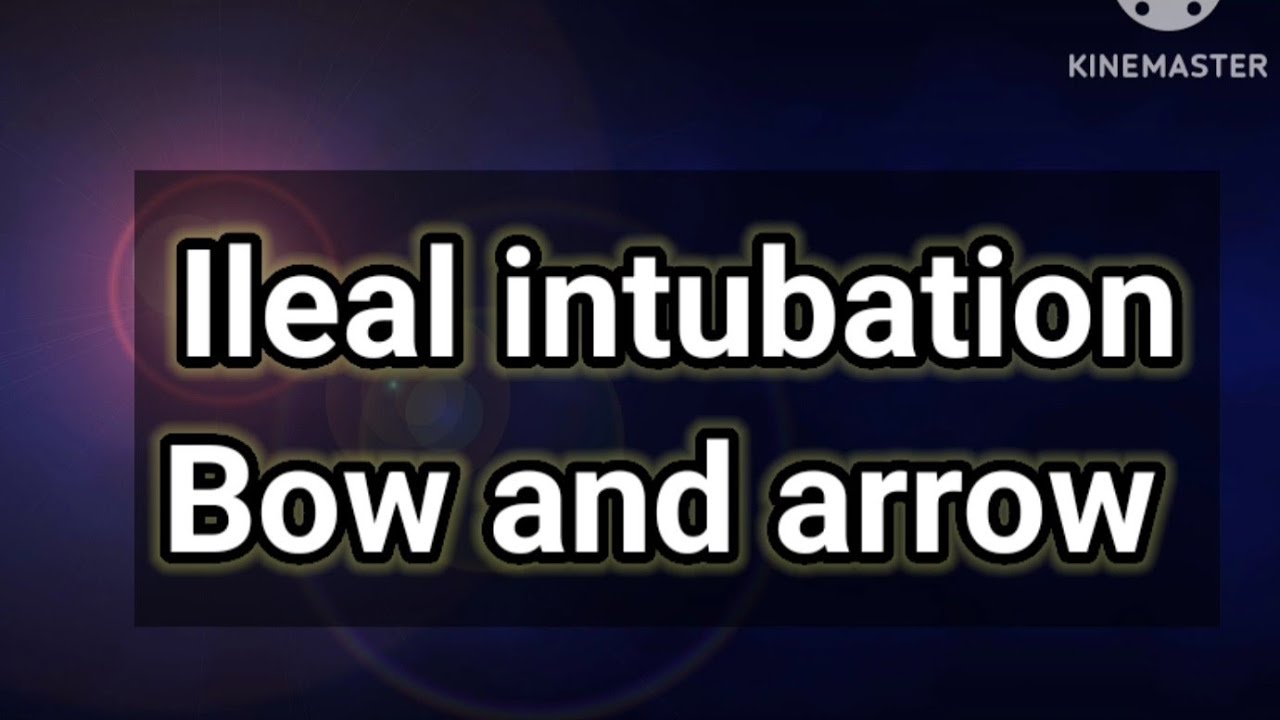 Ileal intubation (Bow and arrow) - YouTube