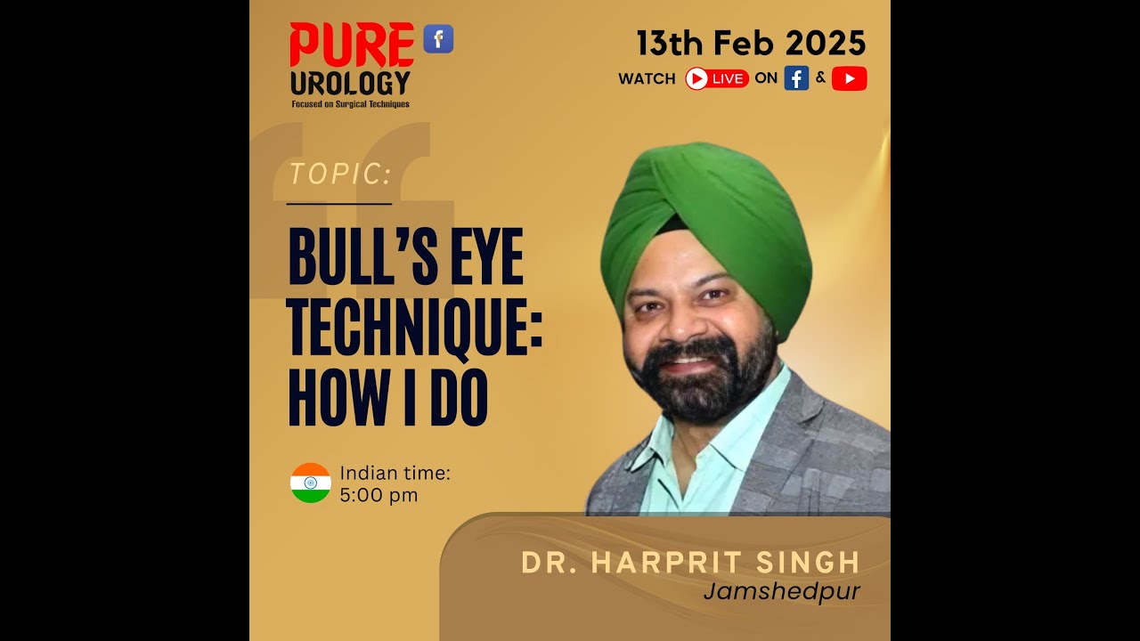 Bull's Eye Technique: How I Do - YouTube