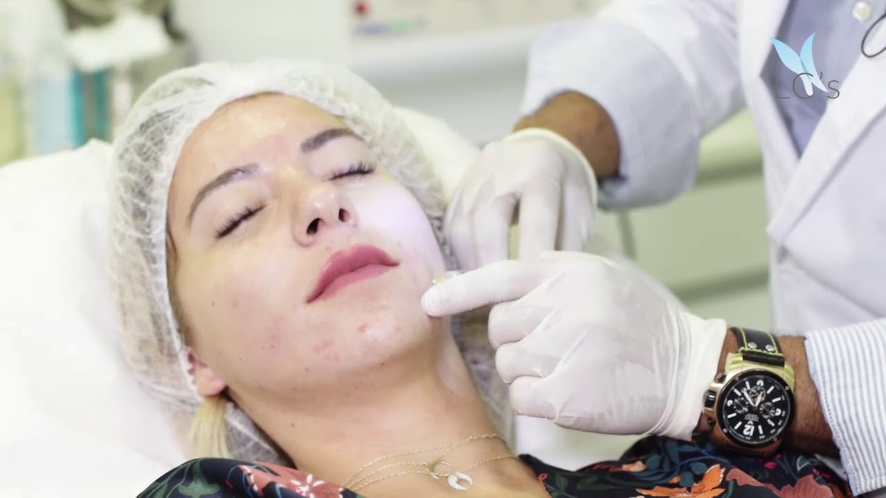 Vitaminas Faciales Inyectadas + Ácido Hialurónico I Rebeca I Beauty ...