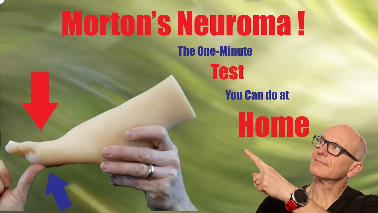 This test will tell you if you have Morton's neuroma - YouTube