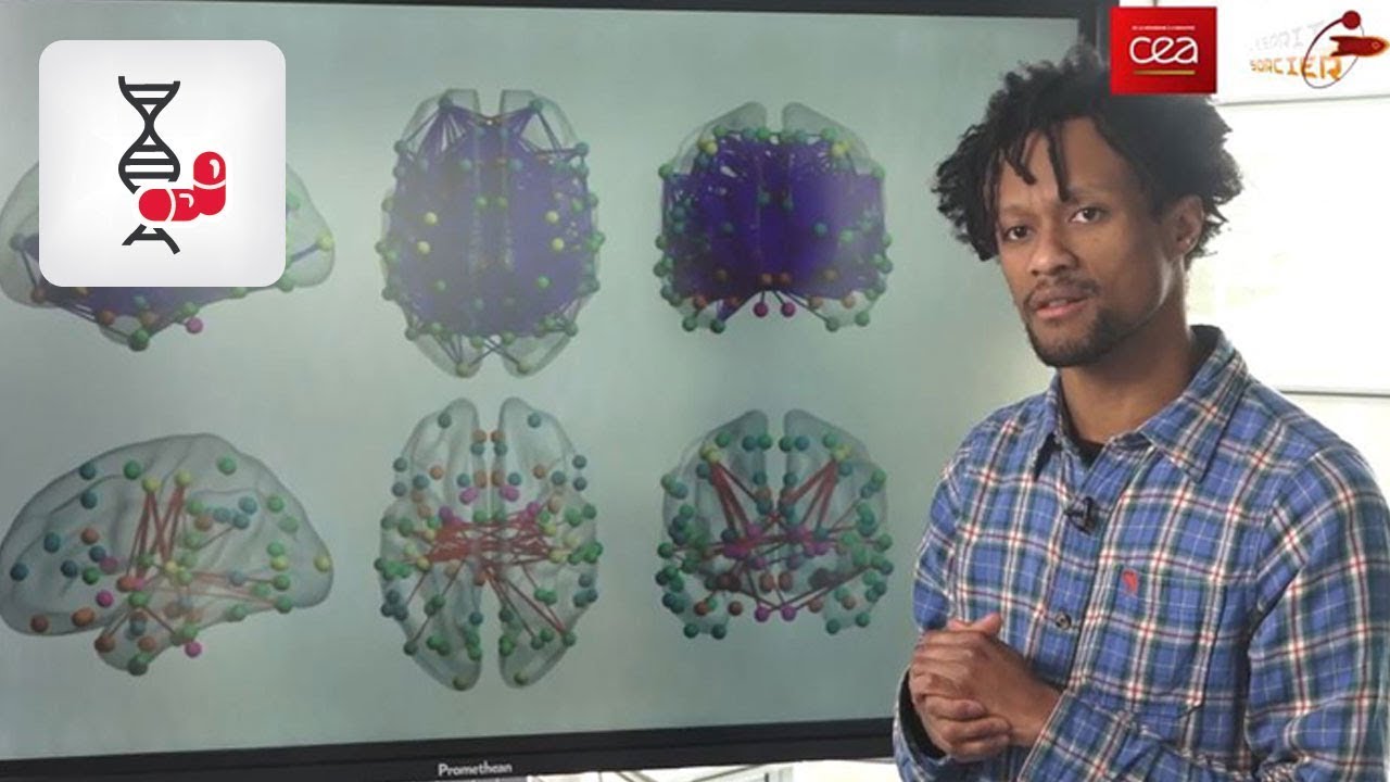 [Interview] Cerveau - L'autisme et l'imagerie cérébrale - YouTube