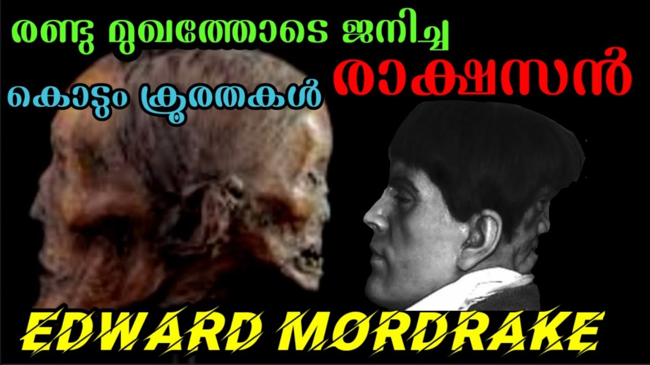 Edward mordrake,Two Faced Man|Person Born with 2 Heads|Man with 2 Faces ...